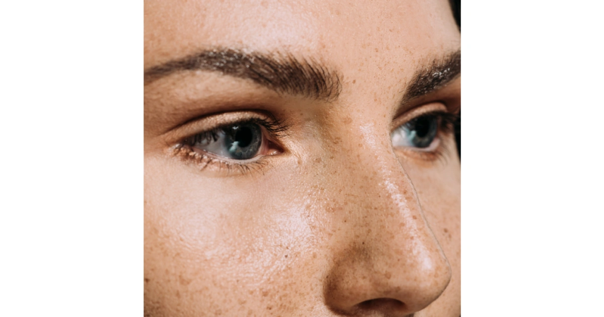 Eye Care in Manchester, NH | Upneeq | The Alchemy Clinic